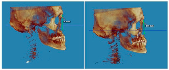 Enhancing Surgical Outcomes via Three-Dimensional-Assisted Techniques ...