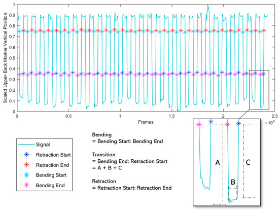 Detecting Fatigue during Exoskeleton-Assisted Trunk Flexion Tasks: A ...