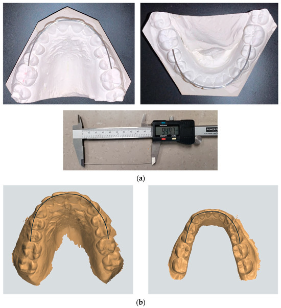 A Comparison of Dental Arch Width and Length on 3D Digital and Plaster ...
