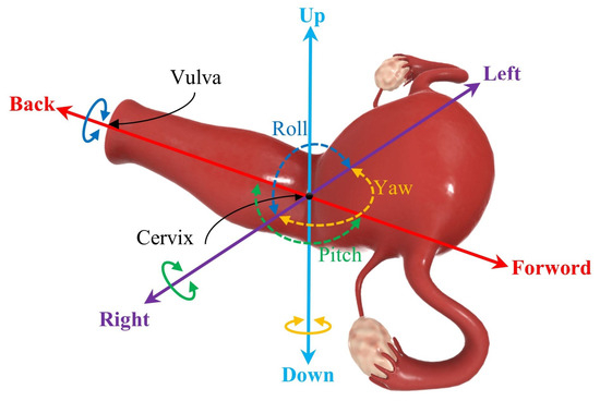 Implementation and Evaluation of a Uterine Manipulation System ...