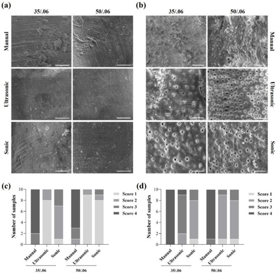 Comparative Evaluation of Ultrasonic and Sonic Irrigant Activation ...