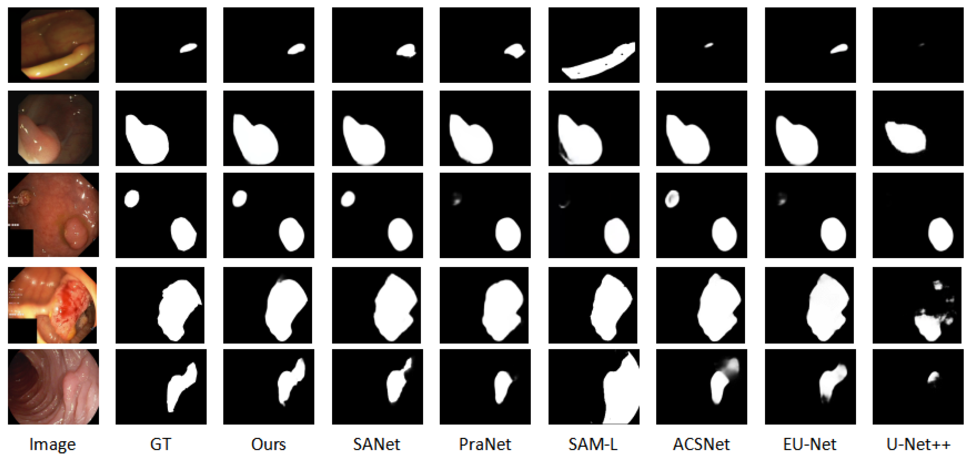 Applied Sciences | Free Full-Text | BMFA-Net: Boundary Constraint Multi-Level Feature ...