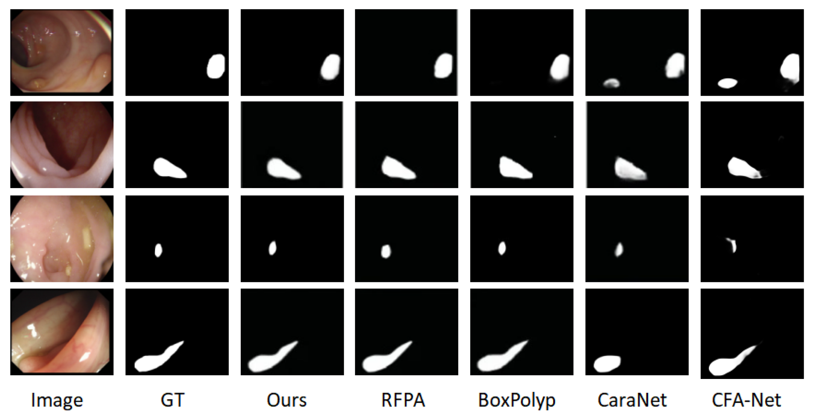 BMFA-Net: Boundary Constraint Multi-Level Feature Aggregation Framework for Precise Polyp ...
