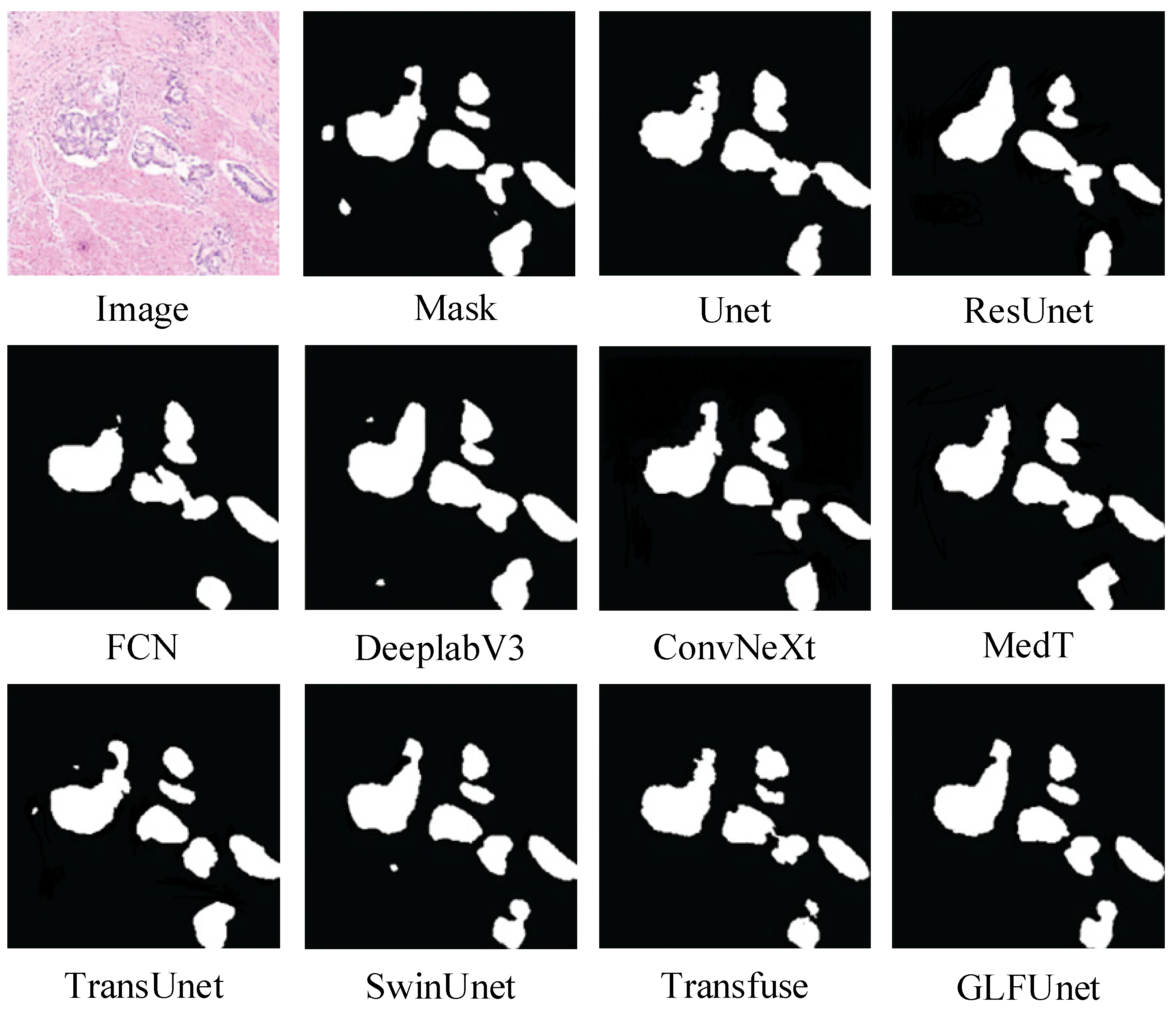 Attention-Based Two-Branch Hybrid Fusion Network for Medical Image ...