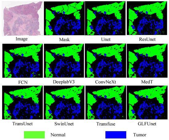 Attention-Based Two-Branch Hybrid Fusion Network for Medical Image ...