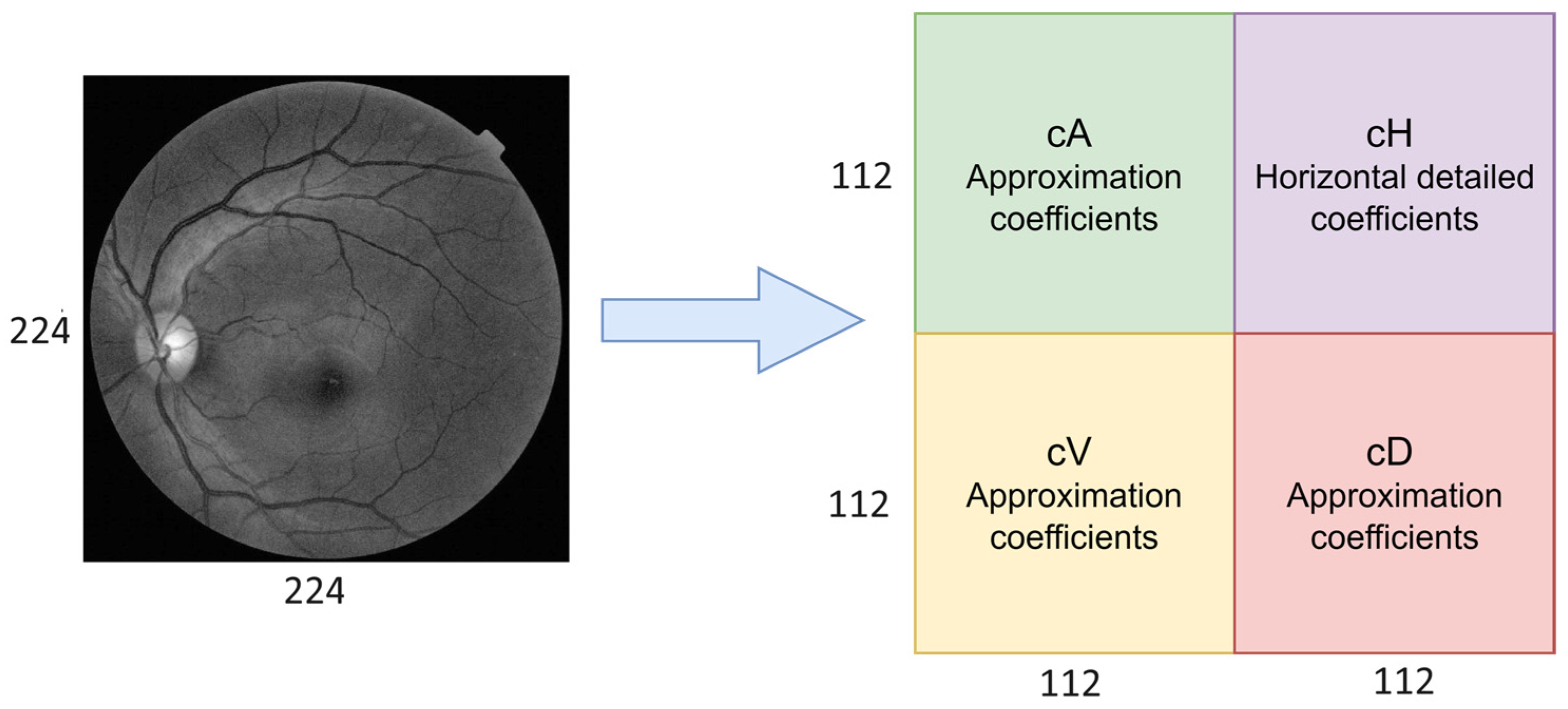 A Deep Learning Model for Detecting Diabetic Retinopathy Stages with Discrete Wavelet Transform