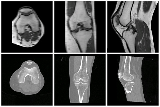 Applied Sciences | Free Full-Text | CycleGAN-Driven MR-Based Pseudo-CT Synthesis for Knee ...