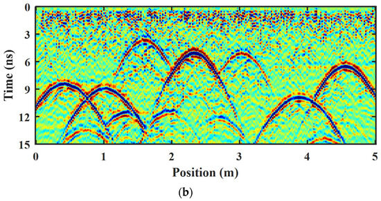 ROI-Binarized Hyperbolic Region Segmentation and Characterization by Using Deep Residual ...
