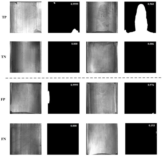 DEU-Net: A Multi-Scale Fusion Staged Network for Magnetic Tile Defect Detection
