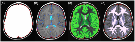 Reliability of Automated Intracranial Volume Measurements by Synthetic ...