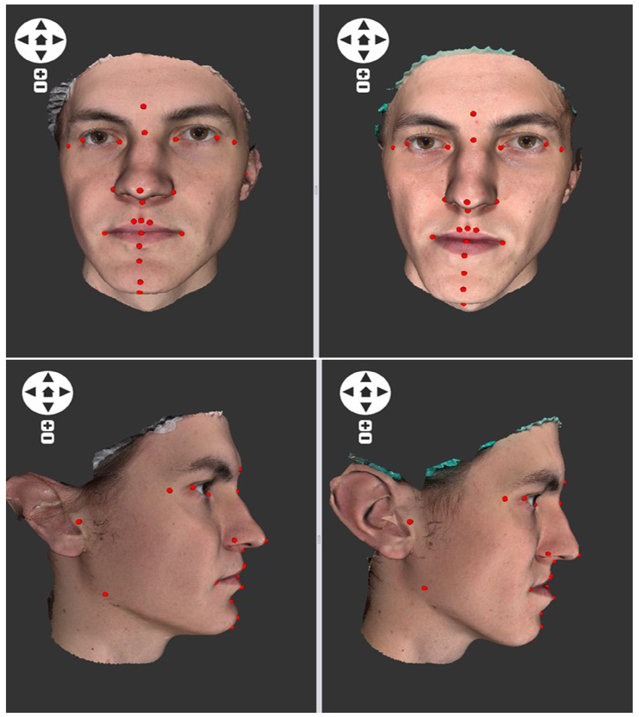 Imaging and 3D Analysis Based on Two or More Three-Dimensional CBCT ...