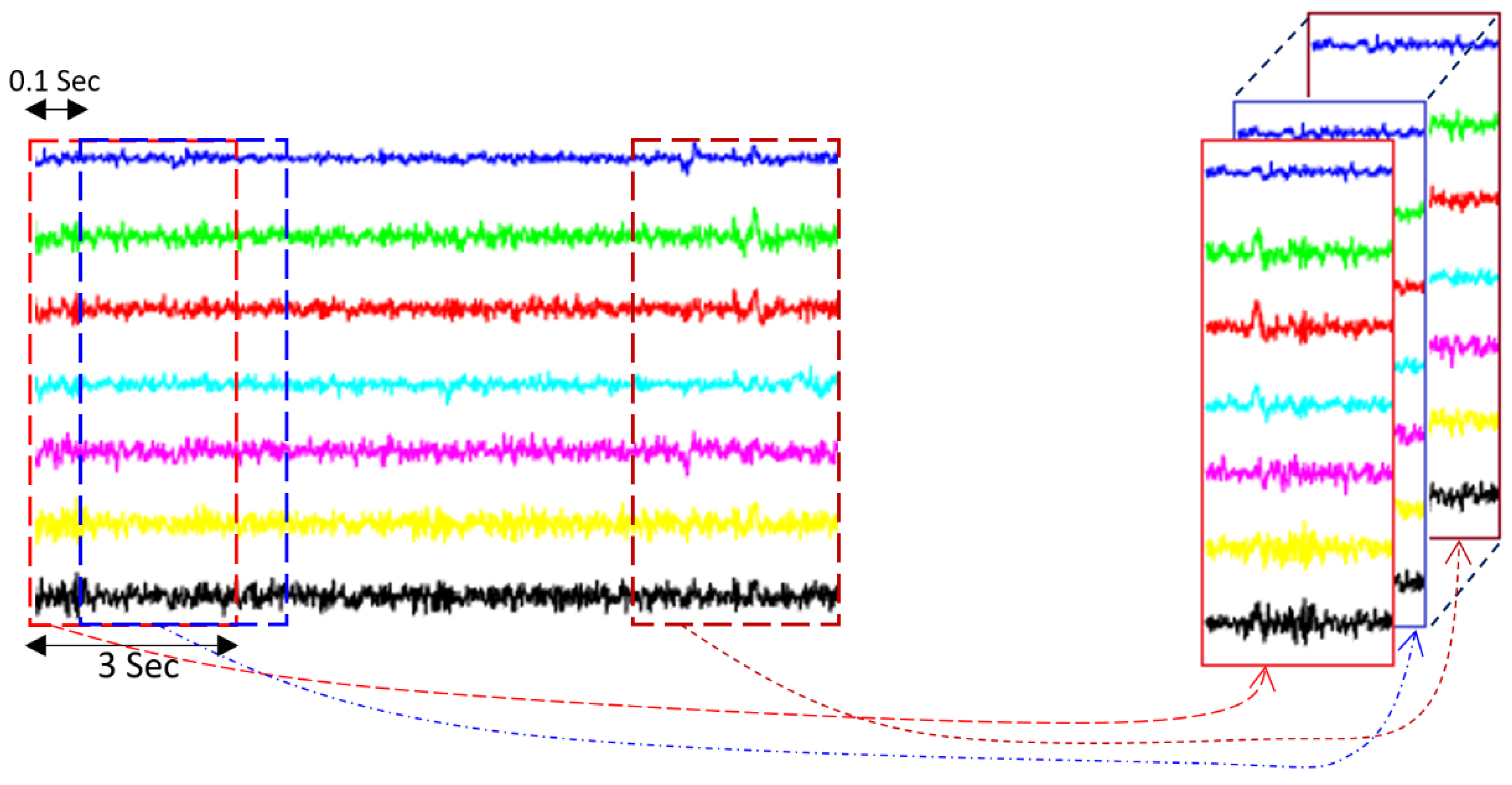 Schizophrenia Detection on EEG Signals Using an Ensemble of a ...