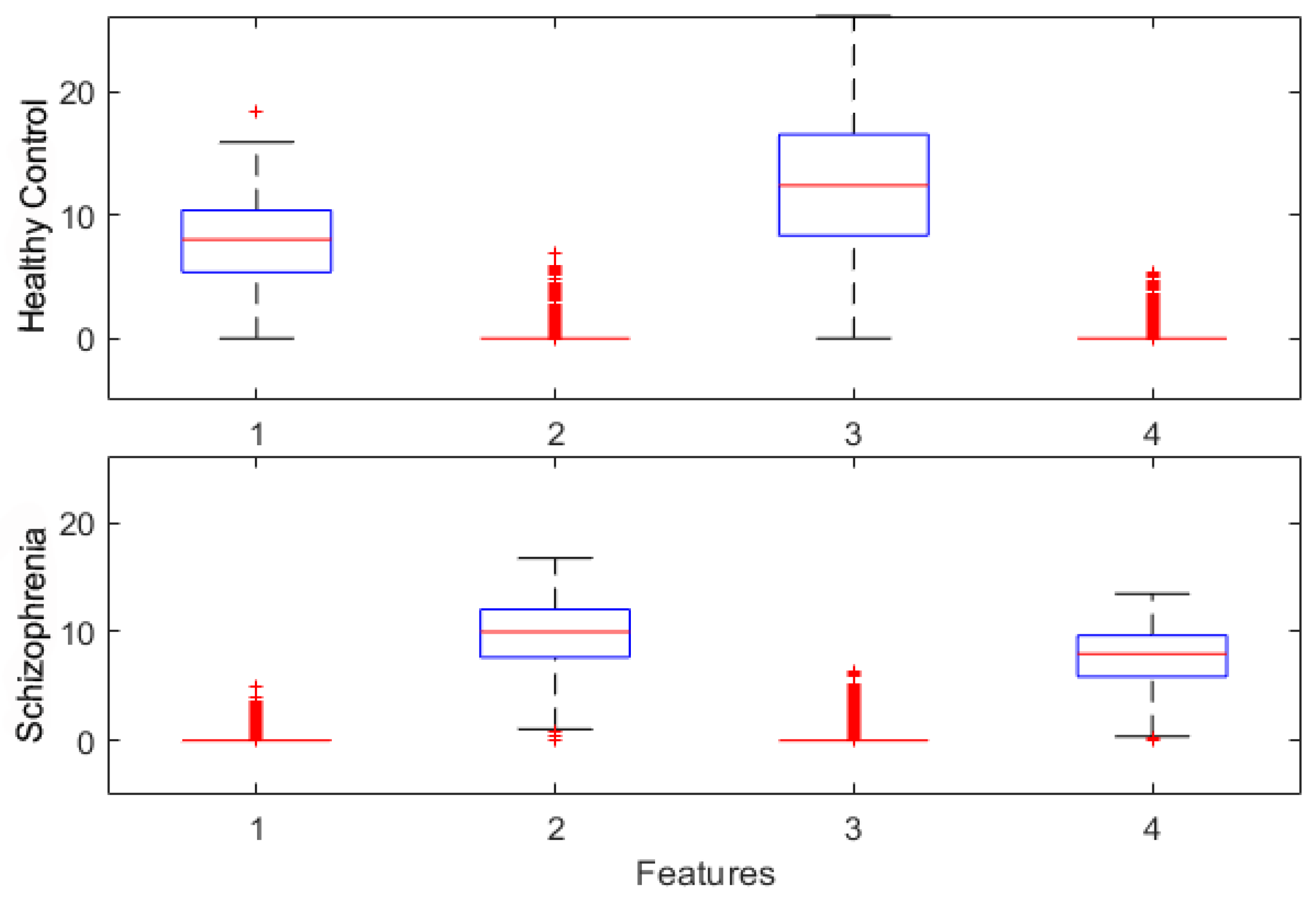 Schizophrenia Detection on EEG Signals Using an Ensemble of a Lightweight Convolutional Neural ...
