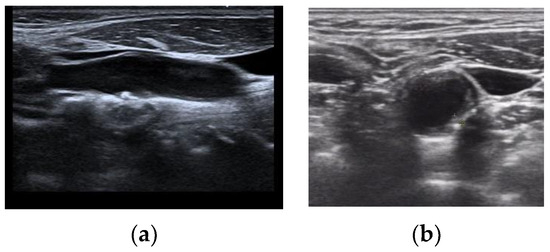 Domain Discrimination Expert Weighted Network for Multi-Source Carotid ...
