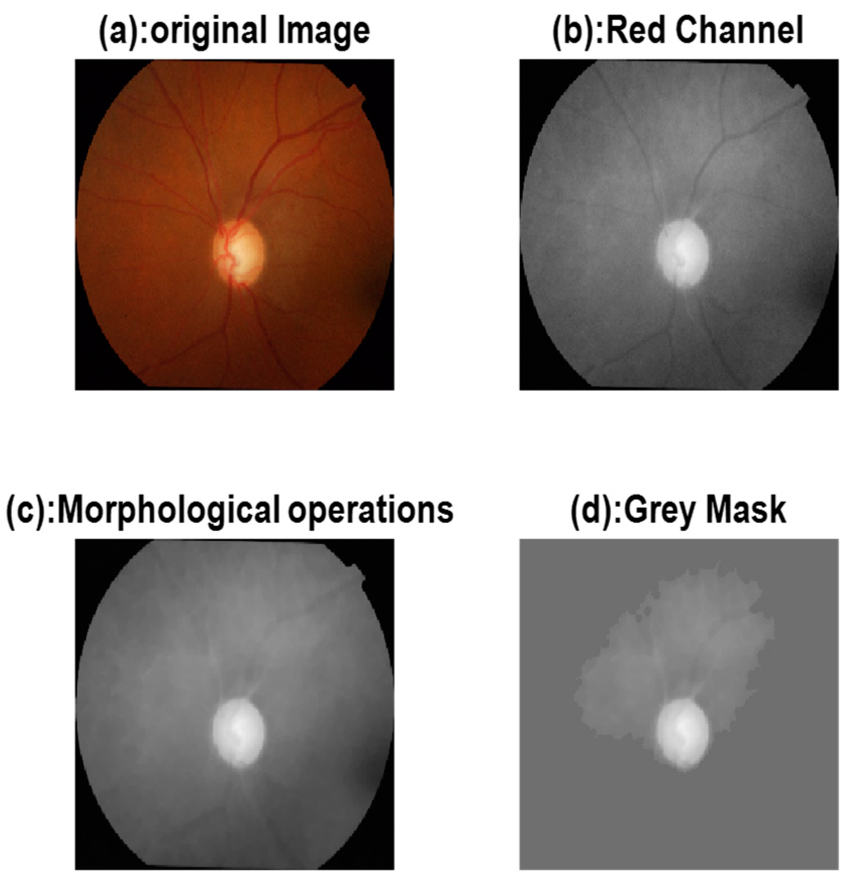 Optic Disc Segmentation in Human Retina Images Using a Meta Heuristic Optimization Method and ...