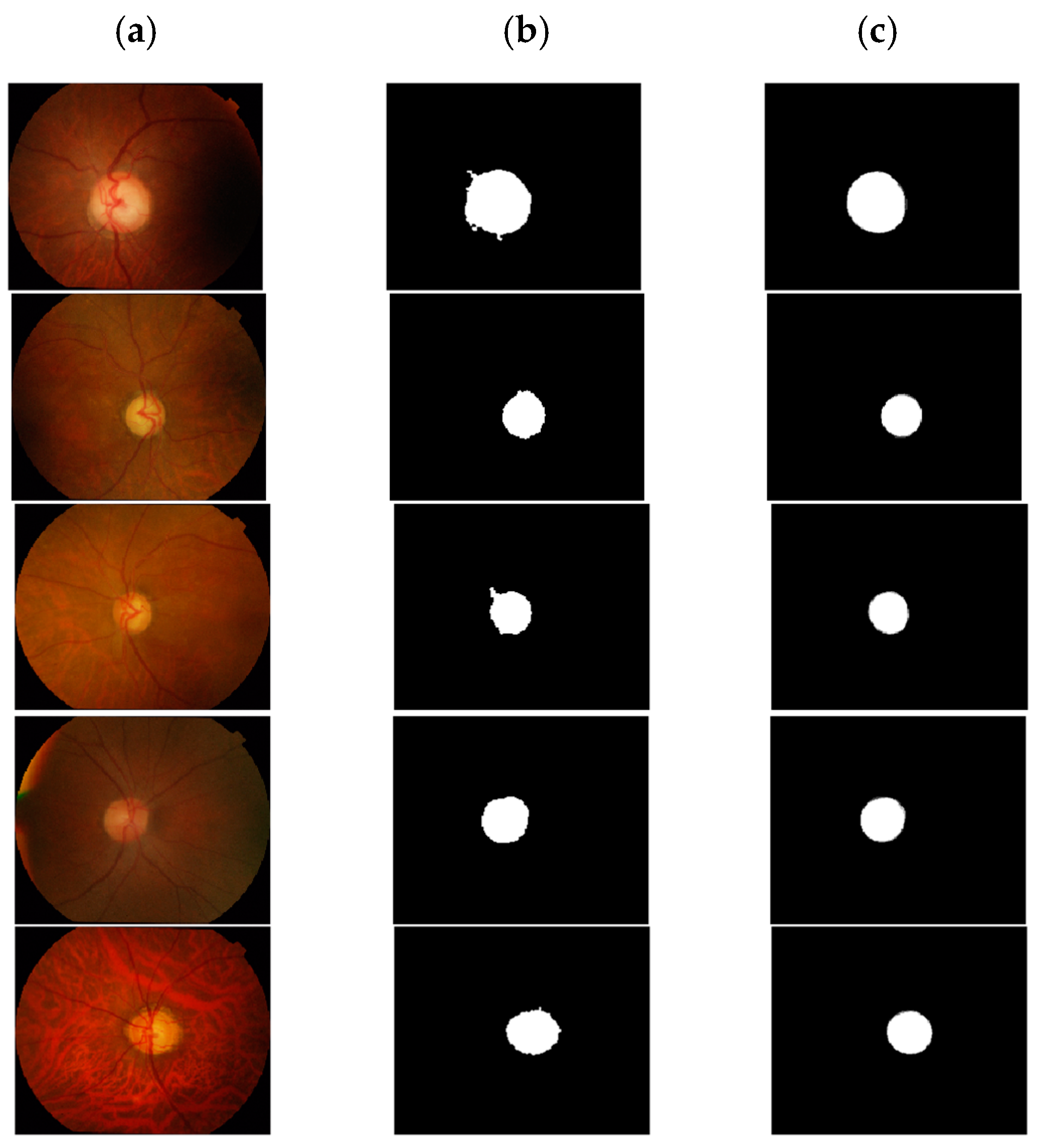 Optic Disc Segmentation in Human Retina Images Using a Meta Heuristic Optimization Method and ...