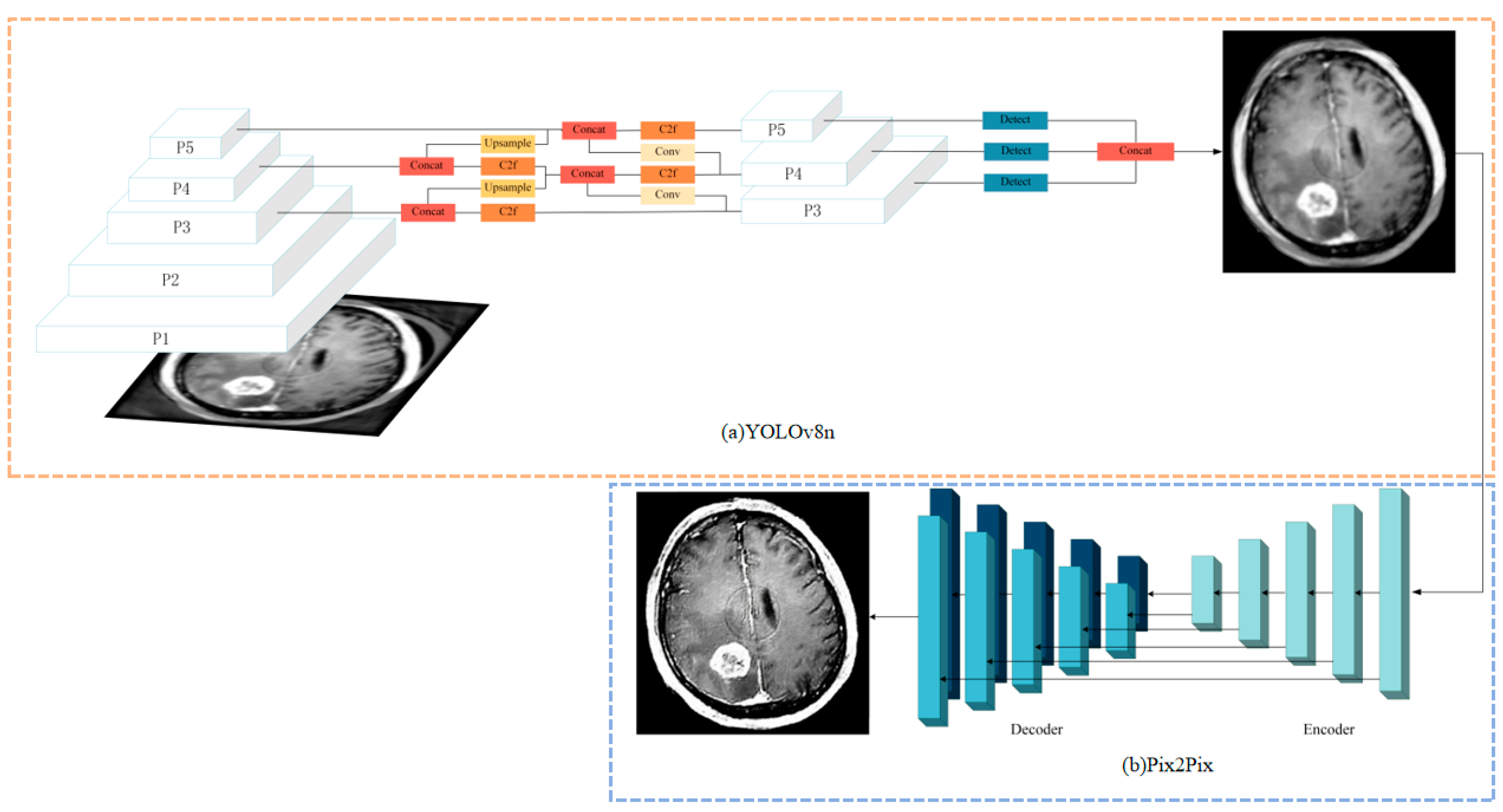 Deep Learning Realizes Photoacoustic Imaging Artifact Removal
