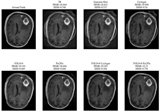 Deep Learning Realizes Photoacoustic Imaging Artifact Removal