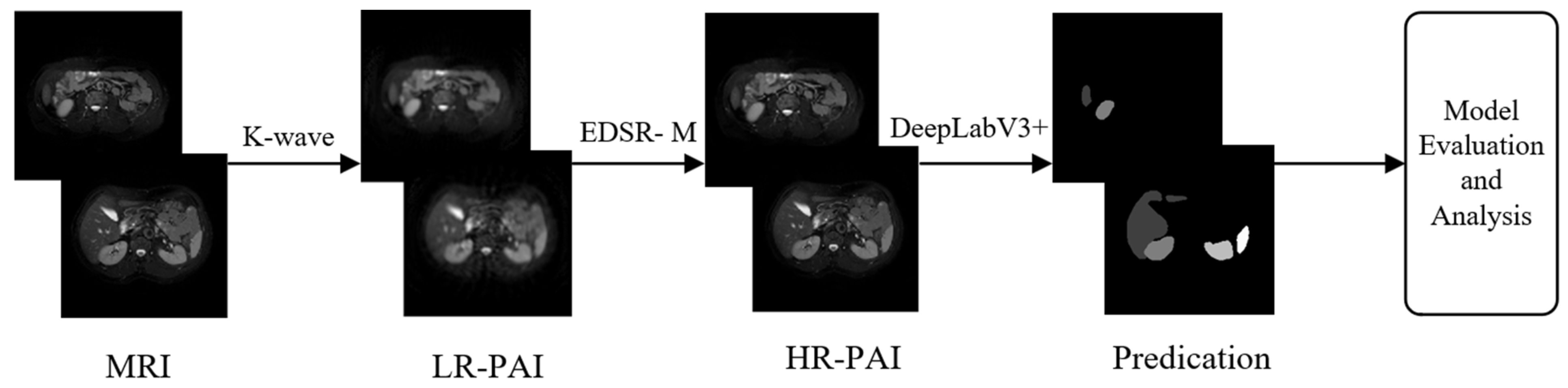 Deep Learning-Based Super-Resolution Reconstruction and Segmentation of ...