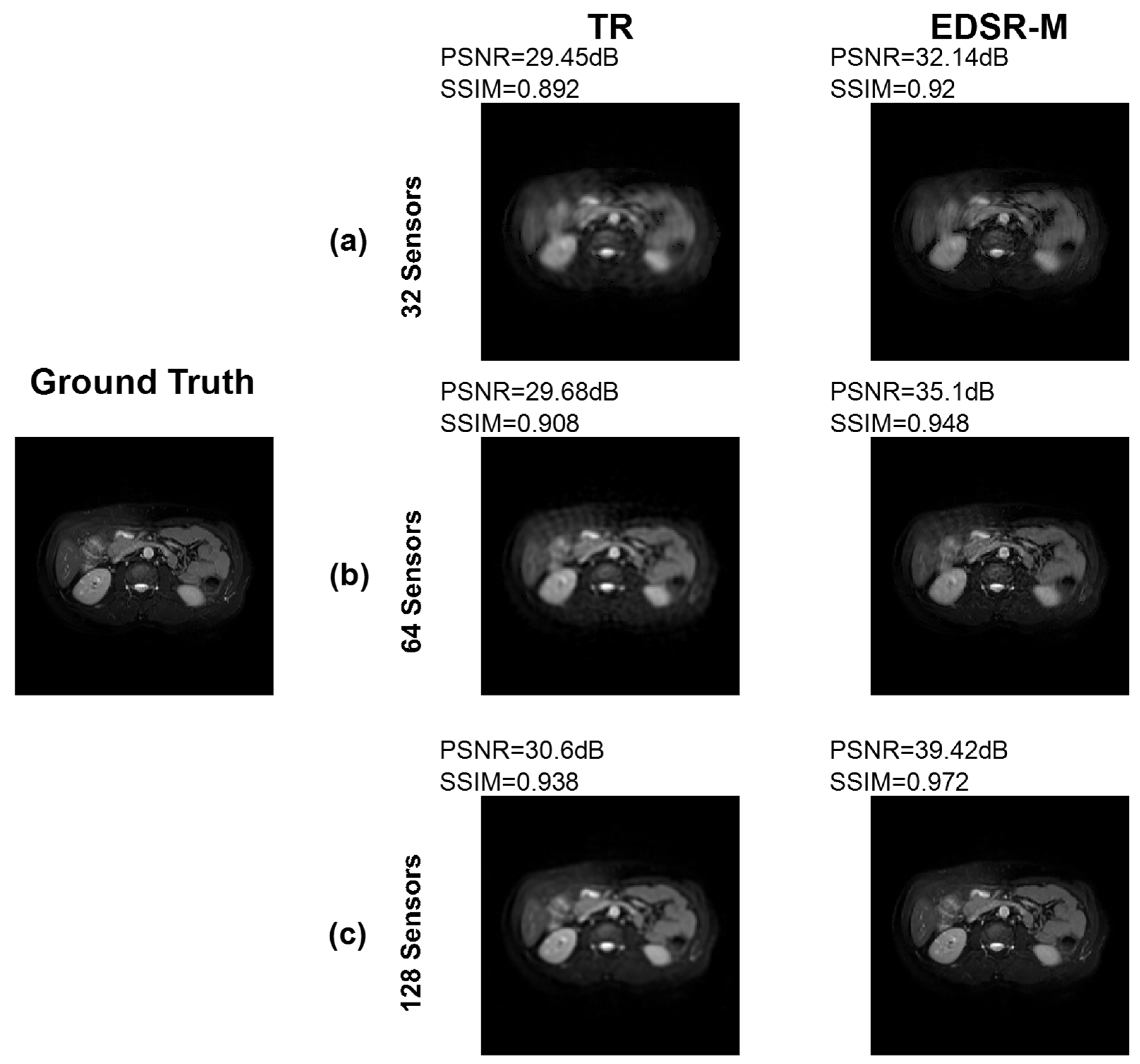 Deep Learning Based Super Resolution Reconstruction And Segmentation Of Photoacoustic Images