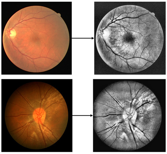 PAM-UNet: Enhanced Retinal Vessel Segmentation Using a Novel Plenary ...