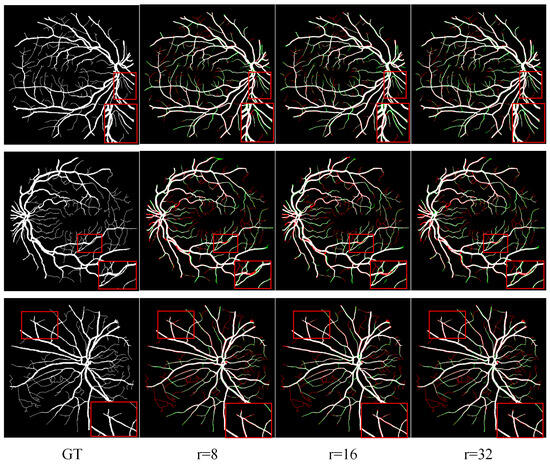 PAM-UNet: Enhanced Retinal Vessel Segmentation Using a Novel Plenary ...