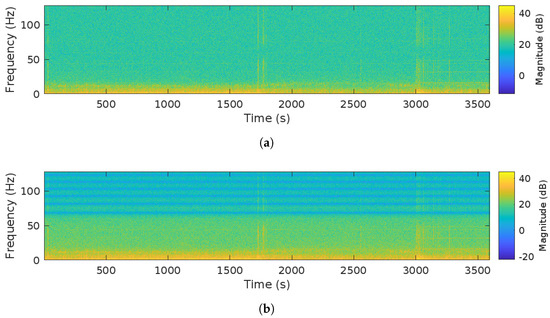 Enhanced Epileptic Seizure Detection Through Wavelet Based Analysis Of Eeg Signal Processing