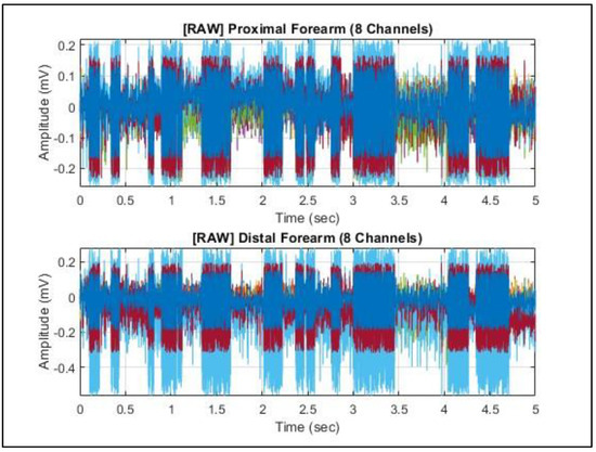 Machine Learning-Based Feature Extraction and Classification of EMG Signals for Intuitive ...