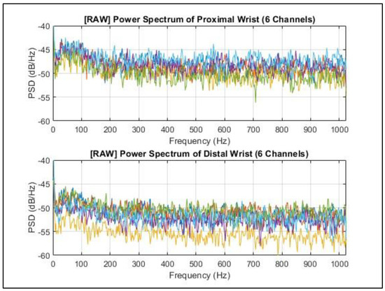 Machine Learning-Based Feature Extraction and Classification of EMG Signals for Intuitive ...