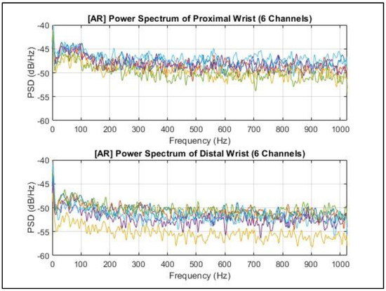 Machine Learning Based Feature Extraction And Classification Of Emg Signals For Intuitive