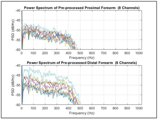Machine Learning Based Feature Extraction And Classification Of Emg Signals For Intuitive
