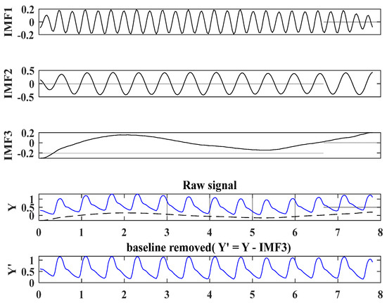 Non-Invasive Continuous Blood Pressure Estimation from Single-Channel ...