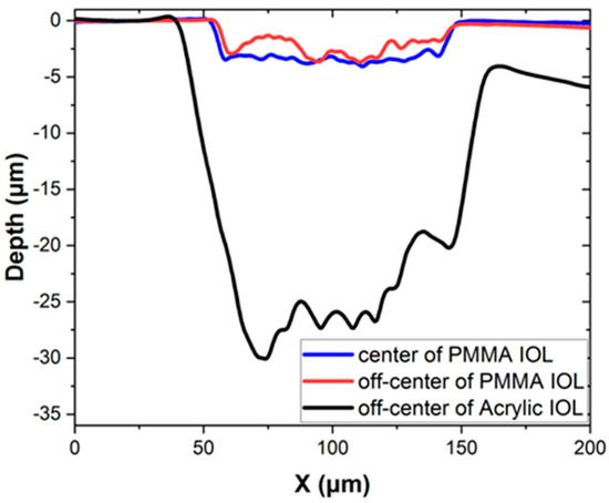 Laser Processing of Intraocular Lenses
