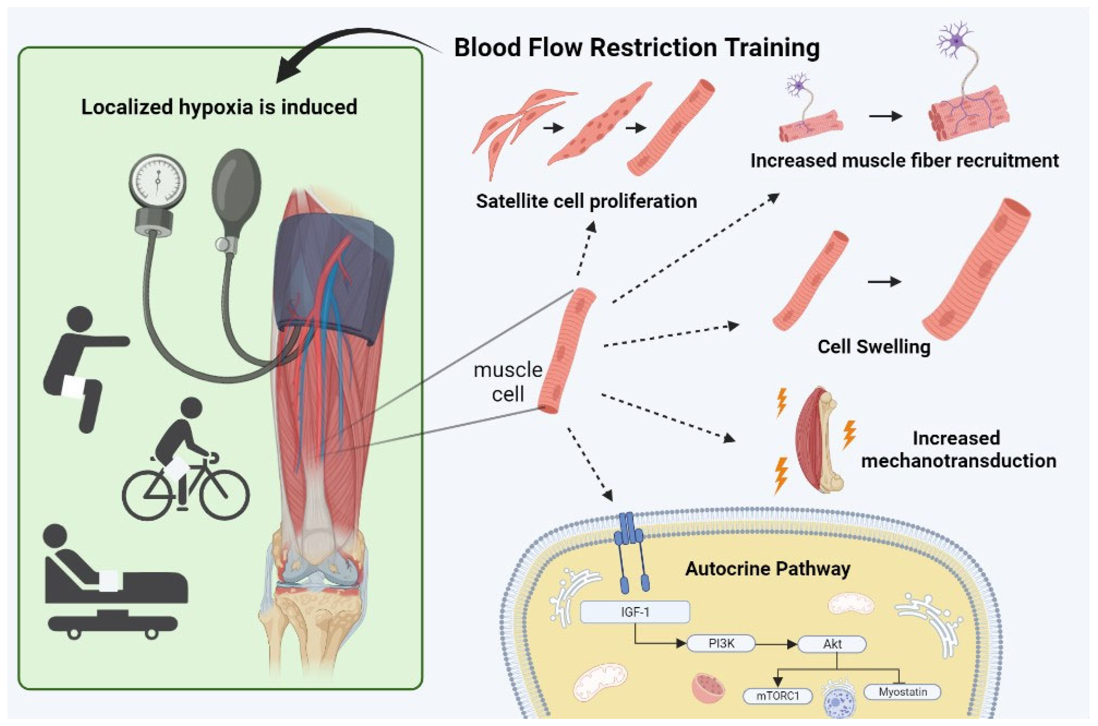 Blood Flow Restriction Exercise as a Novel Conservative Standard in Patients with Knee ...