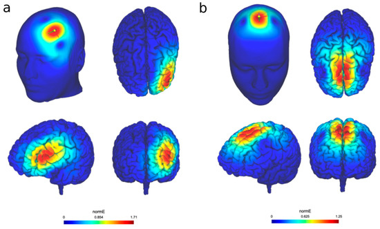 Evaluating the Efficacy of Transcranial Magnetic Stimulation in Symptom ...