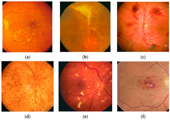 A Miniaturized Large-Field Fundus Optical System Based on Aspheric ...