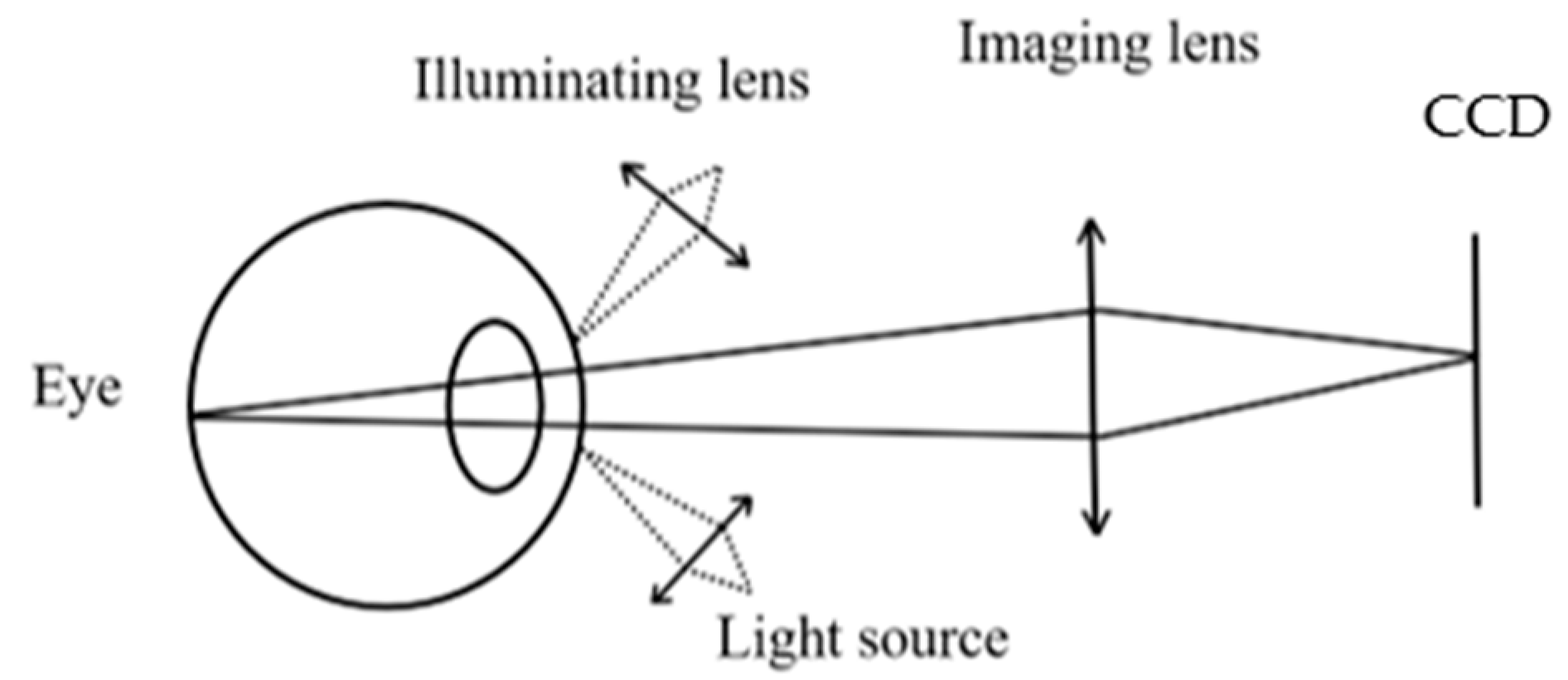 A Miniaturized Large-Field Fundus Optical System Based on Aspheric ...