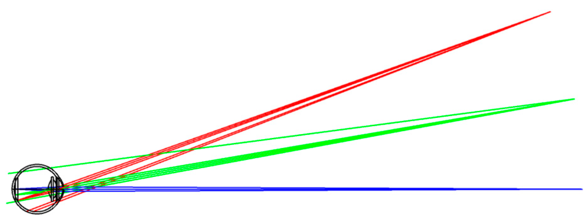 A Miniaturized Large-Field Fundus Optical System Based on Aspheric ...