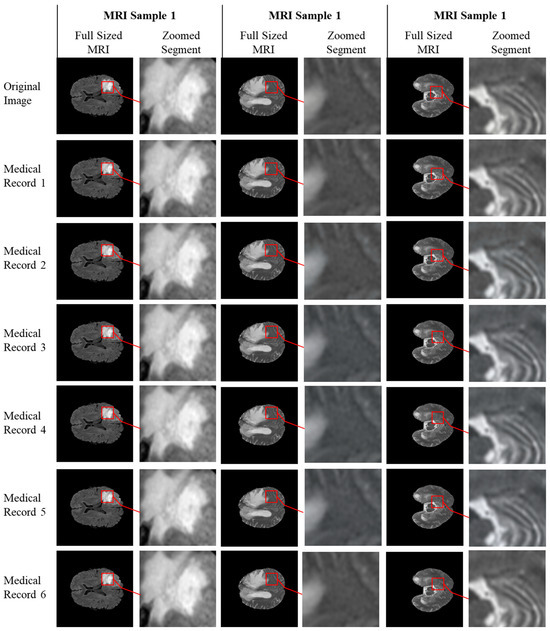 A Novel Fragmented Approach for Securing Medical Health Records in ...