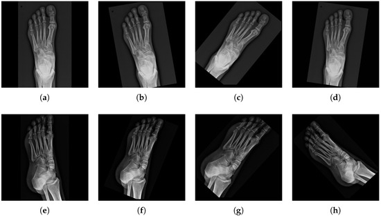 The Automated Generation of Medical Reports from Polydactyly X-ray ...