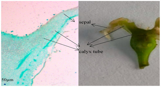 Fruiting Characteristics and Molecular-Assisted Identification of Korla ...