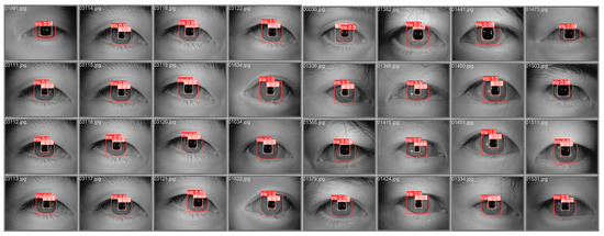 Research On Pupil Center Localization Detection Algorithm With Improved Yolov8 4152