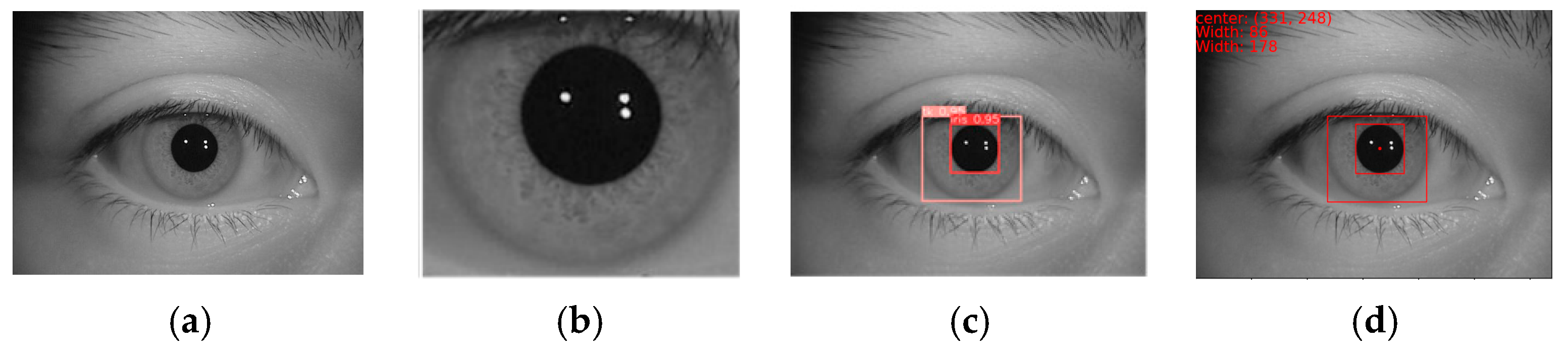Research on Pupil Center Localization Detection Algorithm with Improved YOLOv8