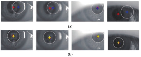 Research On Pupil Center Localization Detection Algorithm With Improved Yolov8