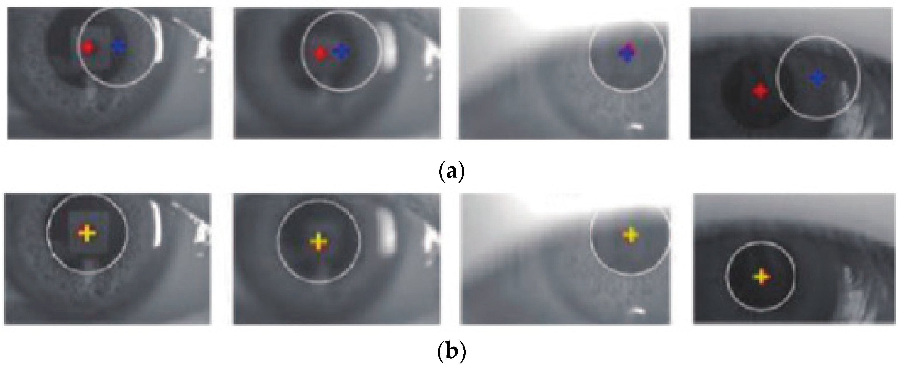 Research on Pupil Center Localization Detection Algorithm with Improved YOLOv8