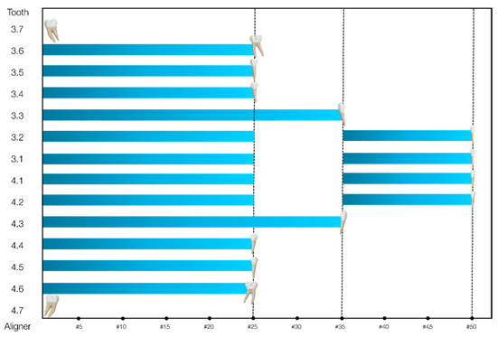 Staging of Orthodontic Tooth Movement in Clear Aligner Treatment: Macro ...