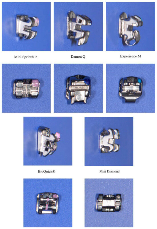 Compressive Strength Comparison of Different Orthodontic Metal Bracket ...