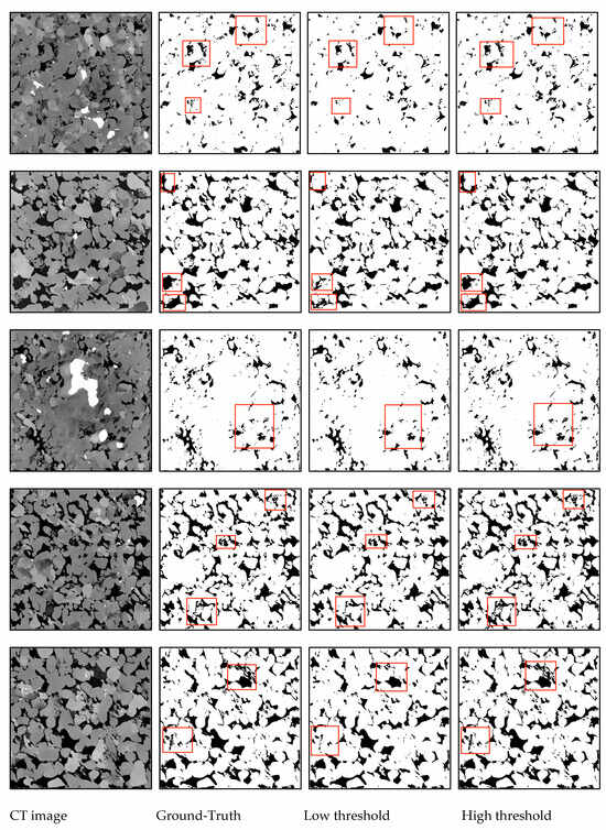 Innovative Deep Learning Approaches for High-Precision Segmentation and Characterization of ...