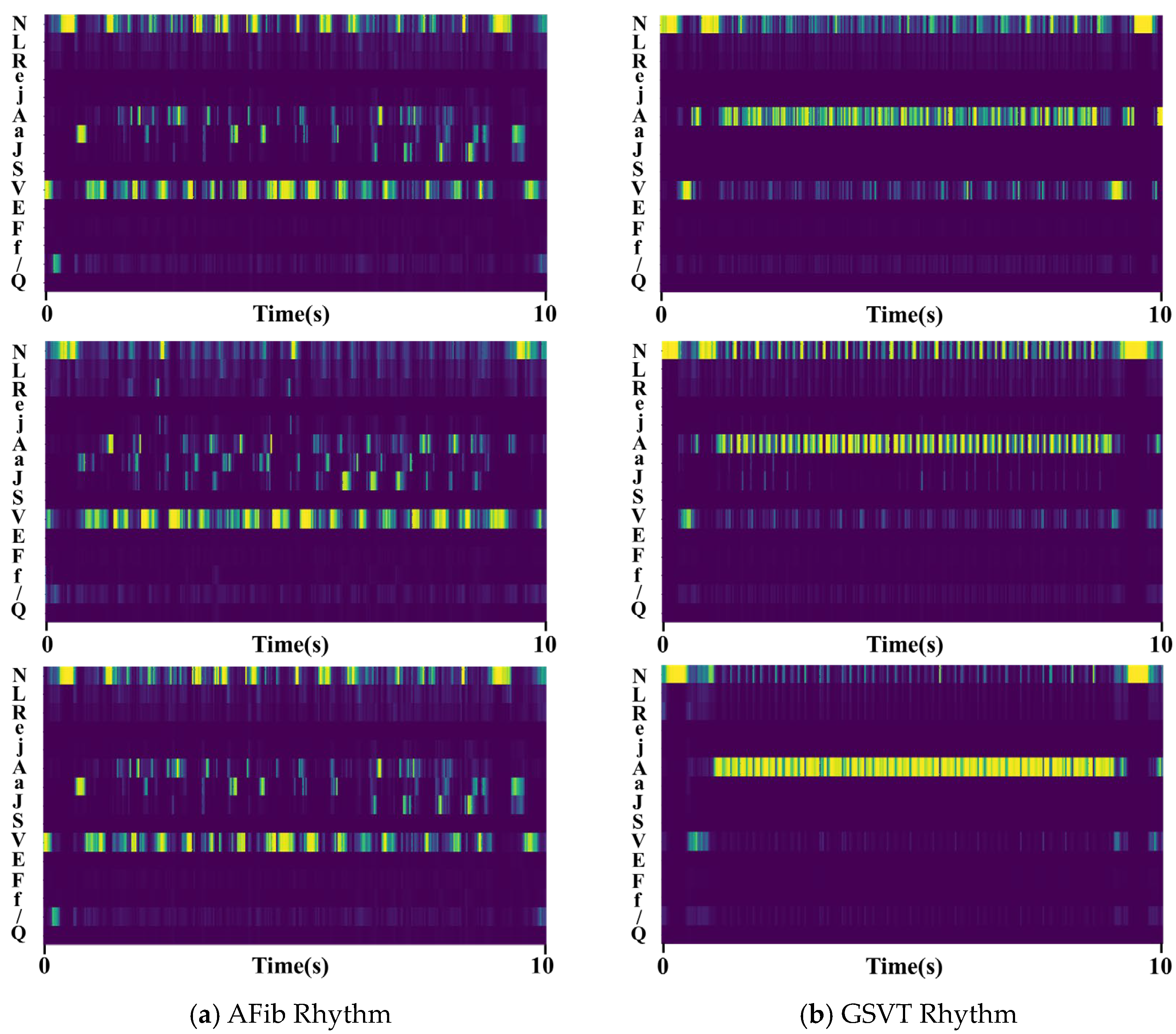 Applied Sciences | Free Full-Text | Enhancing Inter-Patient Performance for Arrhythmia ...