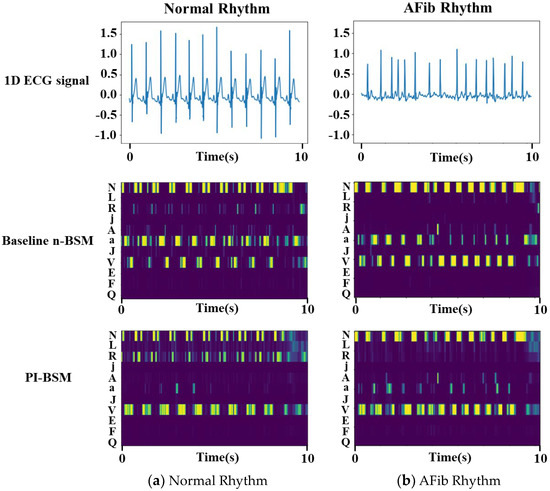 Applied Sciences | Free Full-Text | Enhancing Inter-Patient Performance ...